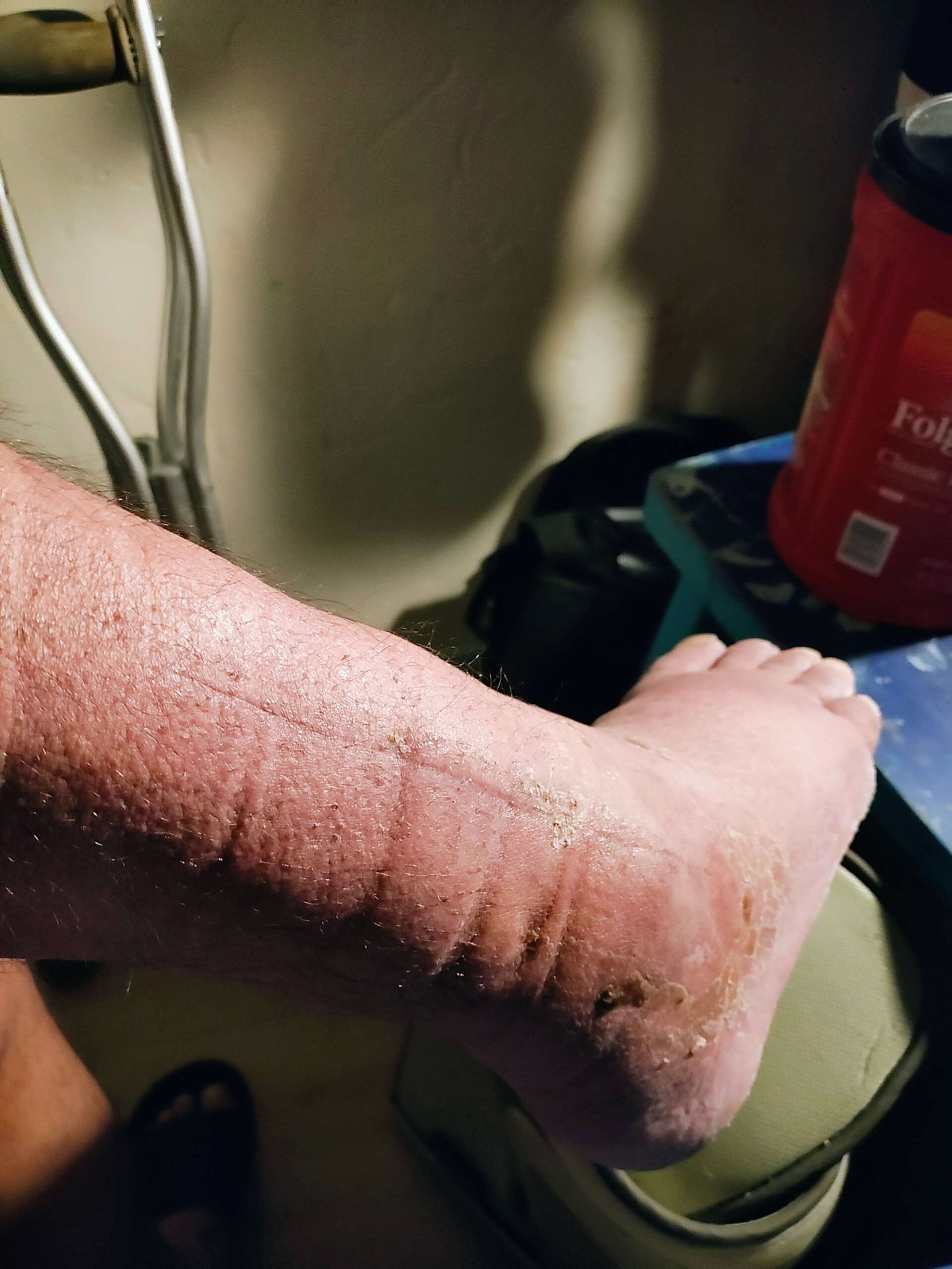 Forum: I'm getting there @Press1 ~CHIMAIRA75, 2025